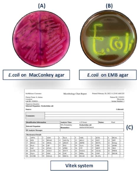Isolation And Identification Of E Coli Isolates Using A MacConkey