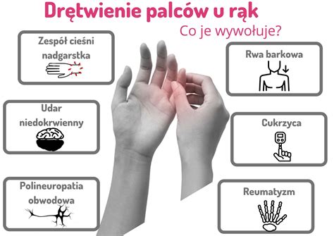 Drętwienie PALCÓW u rąk Leczenie 4 SPOSOBY