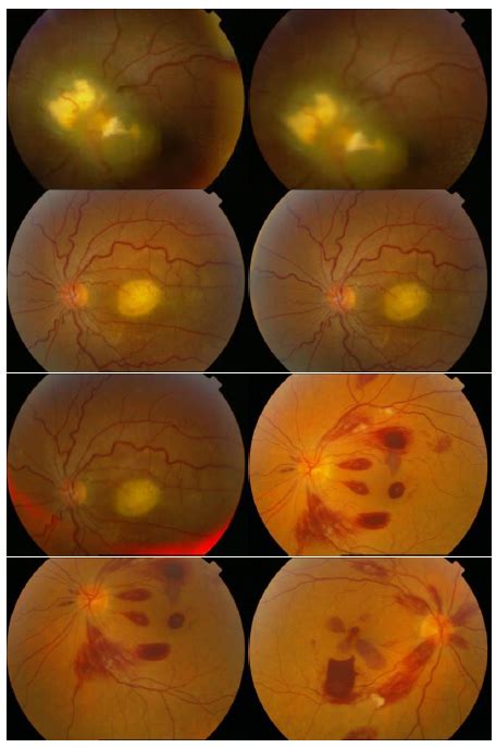 the open medical imaging journal volume 11