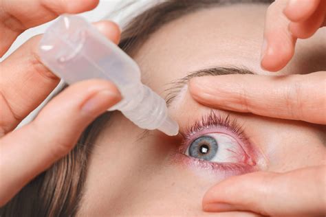 Como Identificar Uma Alergia Nos Olhos Clinica Croce