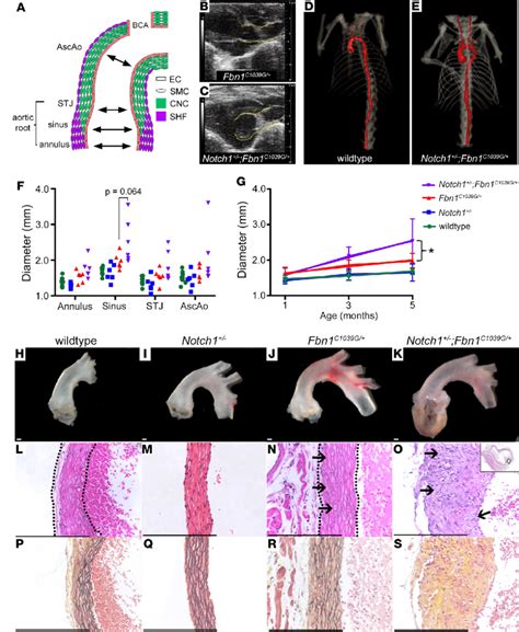 Ascending Aortic Aneurysm Phenotype In Marfan Syndrome Mice Is