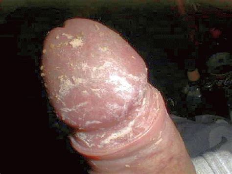 Dick Cheese Porn Telegraph