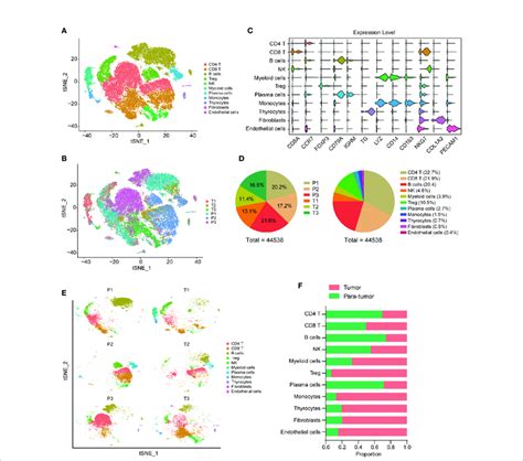 Tumor Environment In Thyroid Cancer T SNE Visualization Of Tumor