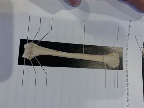 Exercise 10 Appendicular Skeleton Diagram Quizlet
