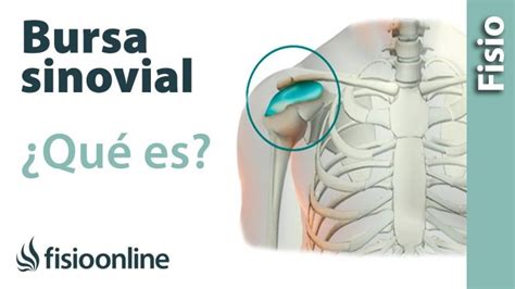 Bursitis Que Es Y Como Se Cura Actualizado Noviembre 2022