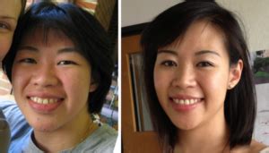 10 Diferencias Principales Entre Los Ojos Japoneses Y Chinos Ieb