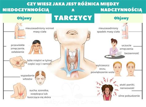 Nadczynność tarczycy jakie są jej przyczyny i objawy Dbam o zdrowie