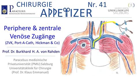 Periphere zentrale Venöse Zugänge ZVK Port A Cath Hickman Co