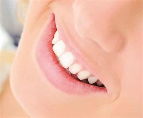 Encías retraídas Causas síntomas y tratamiento Face Clinic
