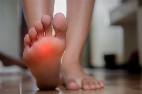 Qué es y cómo tratar el Neuroma de Morton Camde