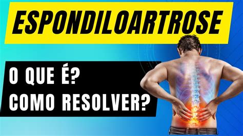 ESPONDILOARTROSE Ou Artrose Na Coluna Como Resolver YouTube