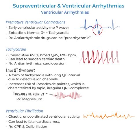 Clinical Pathology Glossary Arrhythmias Ventricular Ditki Medical