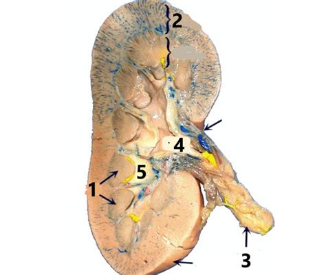 Fetal Pig Urogenital Final Diagram Quizlet