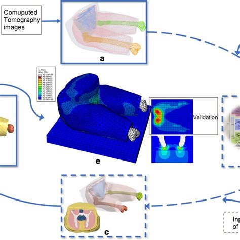 process of parametric finite element modeling a reference buttock download scientific diagram