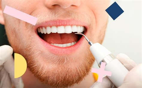 Descubre por qué aparece sarro en tus dientes inferiores y cómo