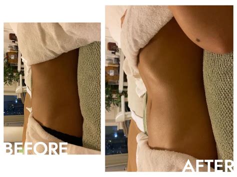 Brazilian Lymphatic Drainage Massages Are Beloved By Celebs
