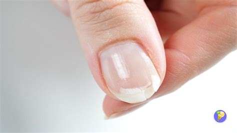 Ongles Cassants 4 Astuces Pour Les Soigner
