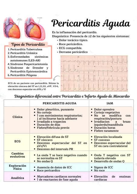 Pericarditis Aguda Maryuri Lisbeth Udocz