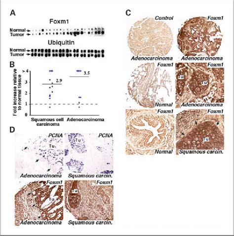 Figure From The Forkhead Box M Transcription Factor Stimulates The