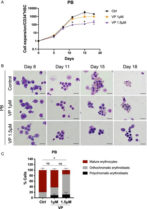 Inhibition Of Yap Taz Tead Interaction By Verteporfin Impaired