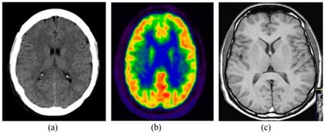 diagnostics free full text deeptumor framework for brain mr image classification