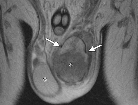 Imaging Of Penile And Scrotal Emergencies Radiographics