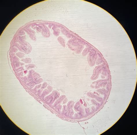 Histology Intestines Flashcards Quizlet