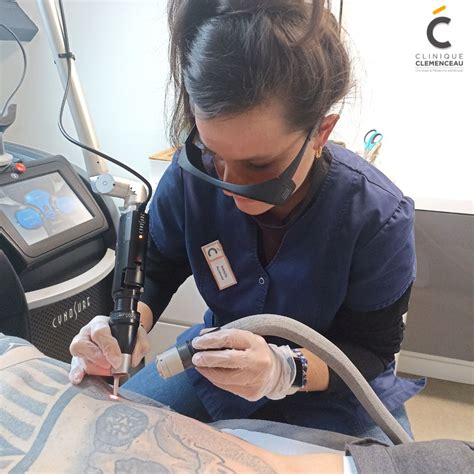 D Tatouage Comment Faire Dispara Tre Son Tatouage Au Laser