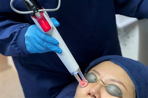 A Complete Guide To Pico Laser Treatment Dream Plastic Surgery