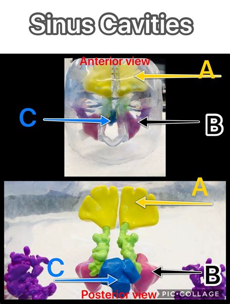 Skull Sinus Cavities Exam Diagram Quizlet