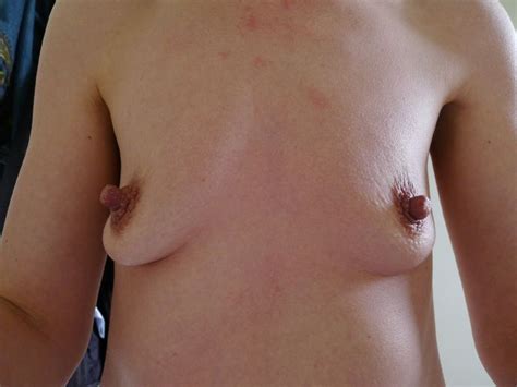 Old Lady Tits Brown Nipples