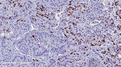 Ki67 IHC Human Tumor Molecular Pathology Core College Of Medicine