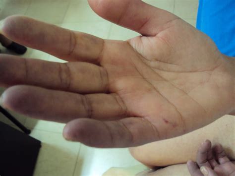 EL RINCÓN DE LA MEDICINA INTERNA juanpedromacaluso yahoo ar
