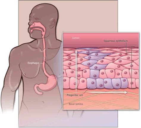 Epithelium Example Link Is External Nonkeratinized Stratified