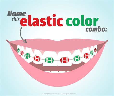 Cute Braces Color Combos Warehouse Of Ideas