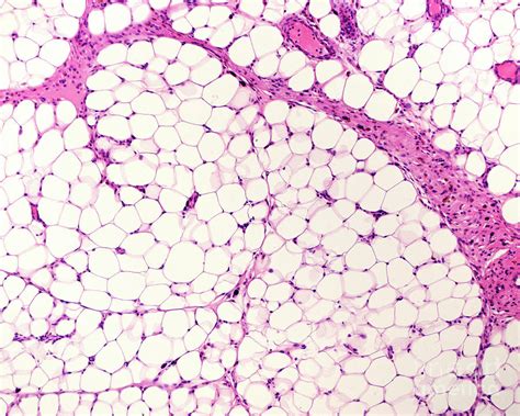 White Adipose Tissue 1 By Science Photo Library