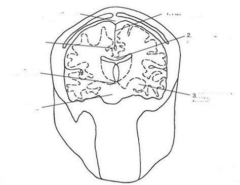 Coronal MRI Head Slice 10 Diagram Quizlet