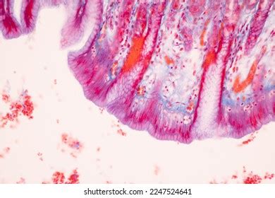 Tissue Small Intestine Duodenum Large Intestine Stock Photo 2247524641