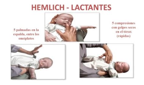 Cómo actuar ante un atragantamiento en niños Cuídate tu Salud