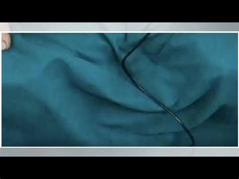Mann Steckt Sich Kabel In Penis Weil Es Ihn Juckte Youtube