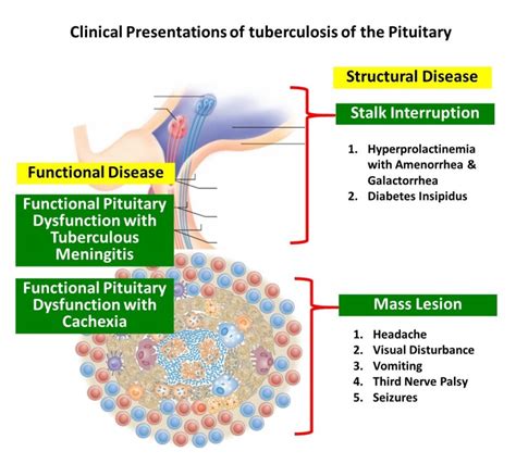 figure 6 [spectrum of structural and functional disease of the pituitary seen with tuberculosis