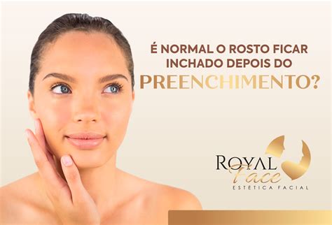 Rosto Inchado Descubra As Causas E Como Tratar O Incha O Facial
