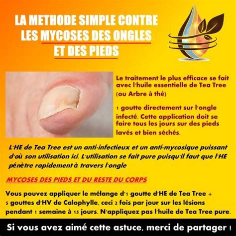 Mycose Entre Les Orteils Remede De Grand Mere AUTOMASITES