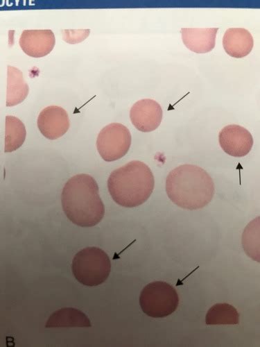 Hematology Lab Quiz 1 Flashcards Quizlet