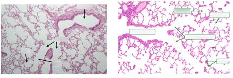 Lung Histology Diagram Quizlet