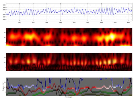 comparison of the spectrogram wavelet scalogram and hilbert spectrum download scientific