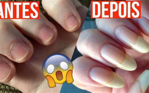 Dica Caseira Para Ter Unhas Grandes E Resistentes Apenas 3