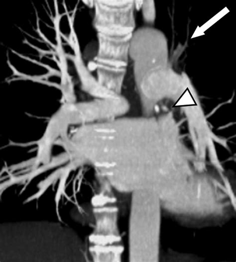 Applications Of Time Resolved MR Angiography AJR
