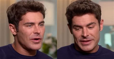 Zac Efron Finally Addresses Plastic Surgery Rumors