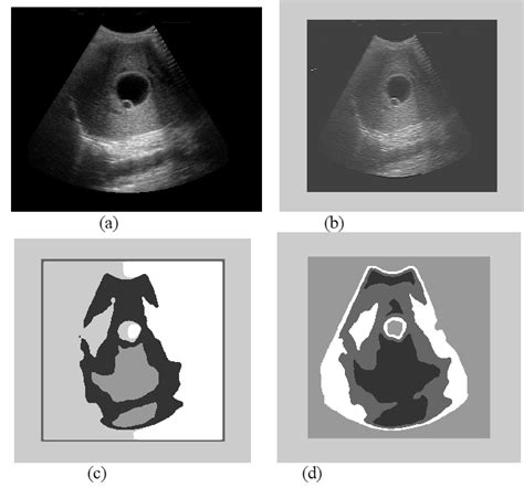 figure 1 from us image segmentation based on expectation maximization and gabor filter